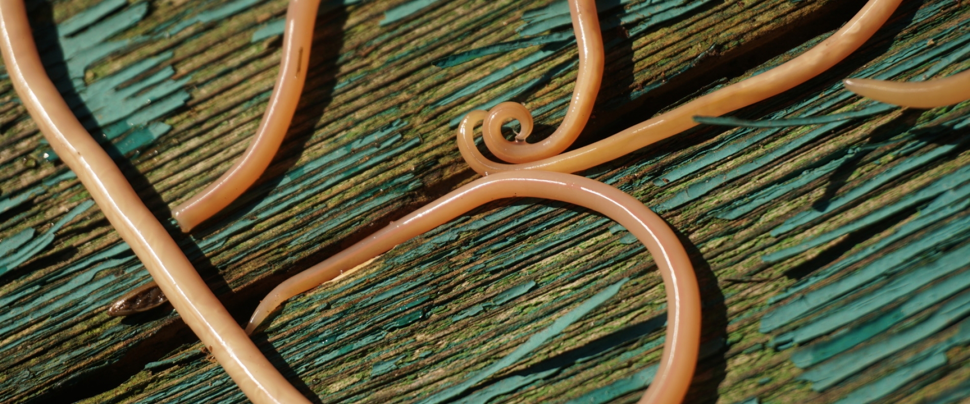 Glistnica - toksokaroza